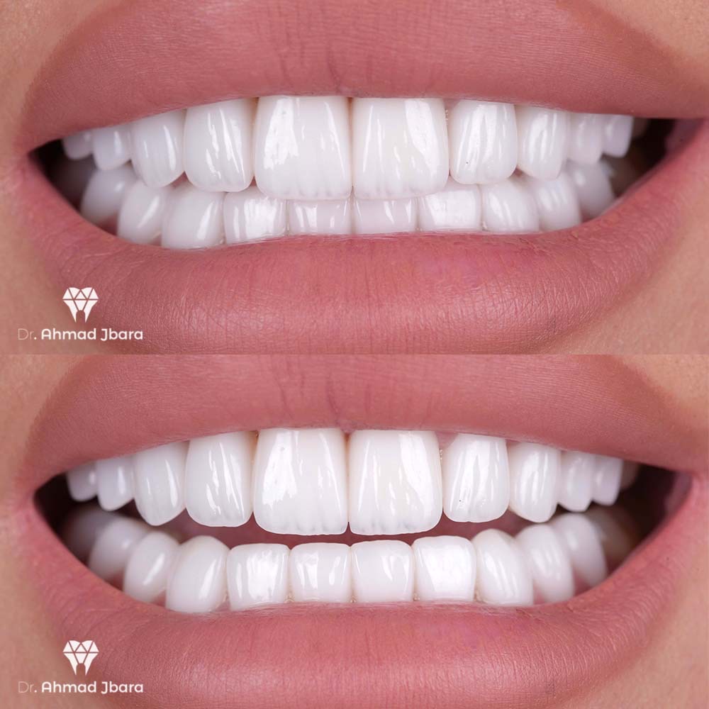 Dr. Ahmad Jbara – Chirurgie Orala, Implantologie, Estetica Dentara